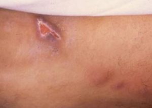 Nine Beavers Dead From Tularemia, A Disease That Can Also Affect Humans ...